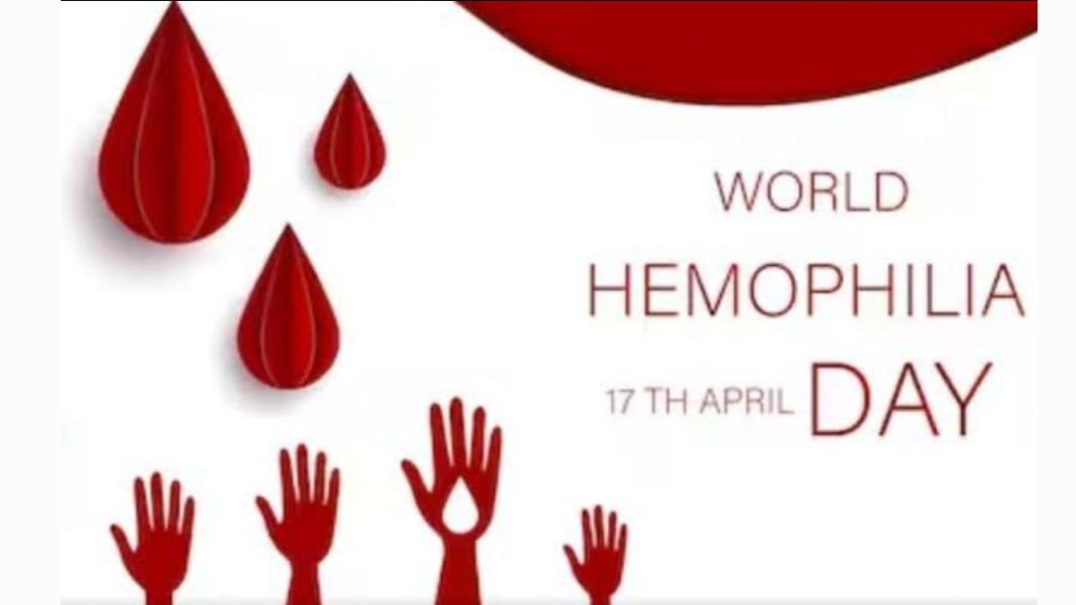 World Haemophilia Day 2025: What Is It, What Are The Symptoms And How To Prevent - Explained ...